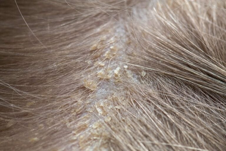 Common Dog Skin Problems, Symptoms & Treatment - The Goody Pet