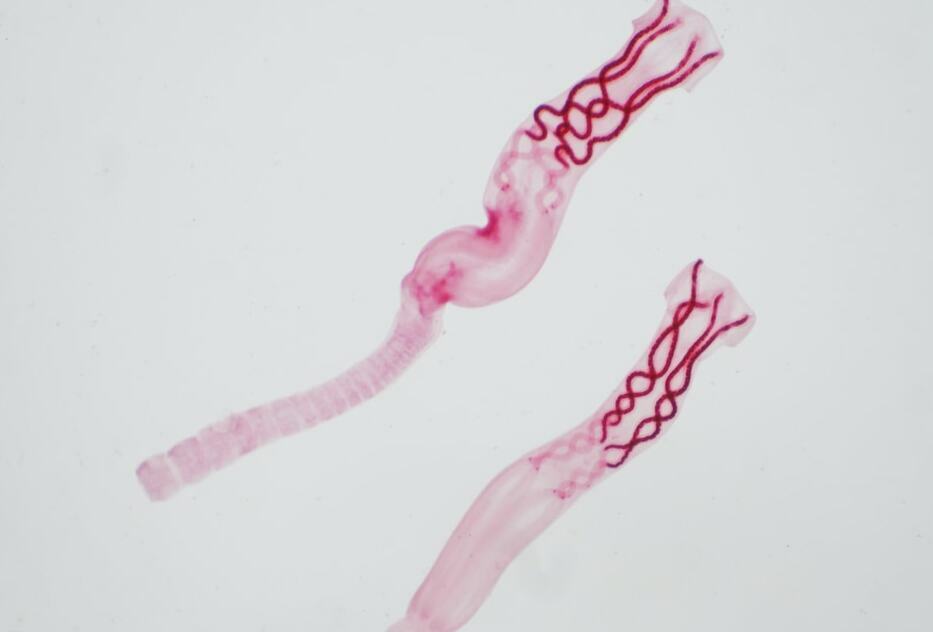 Types Of Intestinal Parasites And Worms In Dogs - The Goody Pet